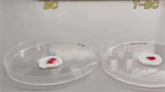 Optical fiber sensors make for a smarter wound dressing | GlobalSpec