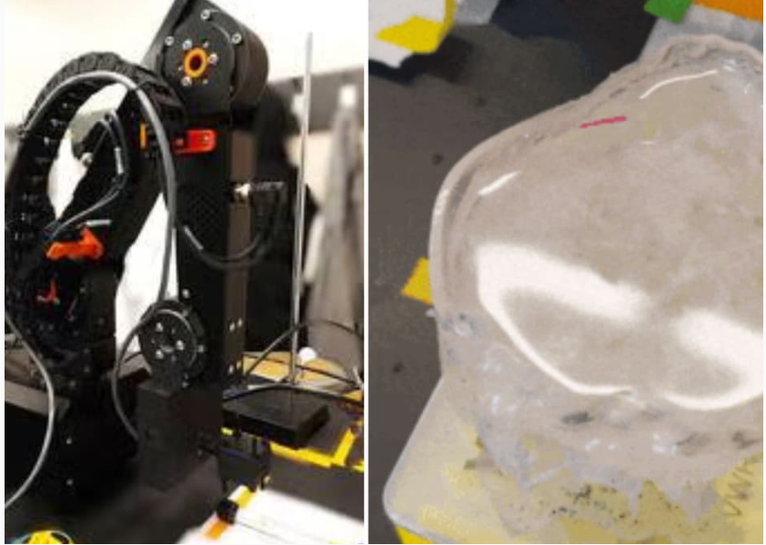 Magnetic micro-robot promises to dissolve kidney stones with less ...