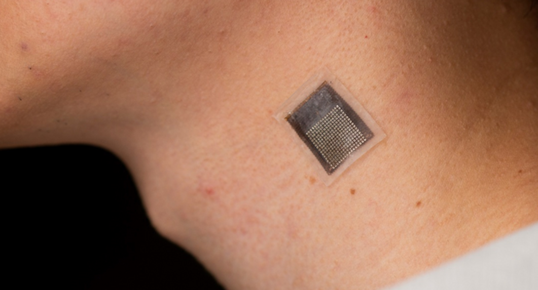Tiny patch takes ultrasounds | GlobalSpec
