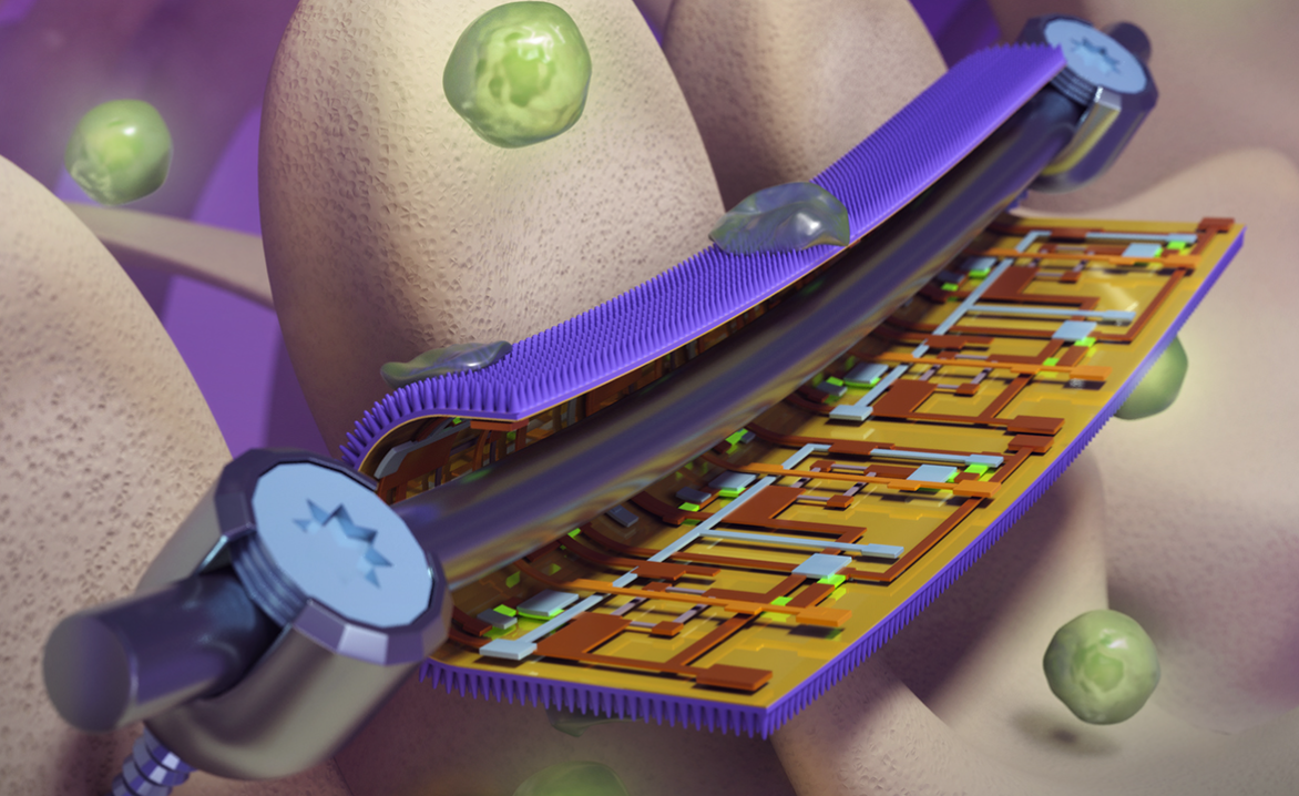 Smart coating simultaneously kills bacteria, monitors implant strain ...