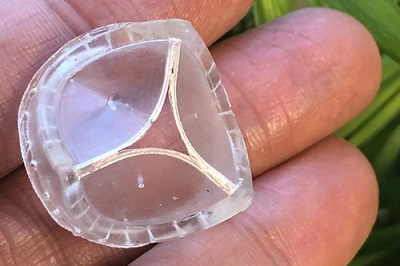 Polymeric heart valve proves durable and biocompatible | GlobalSpec