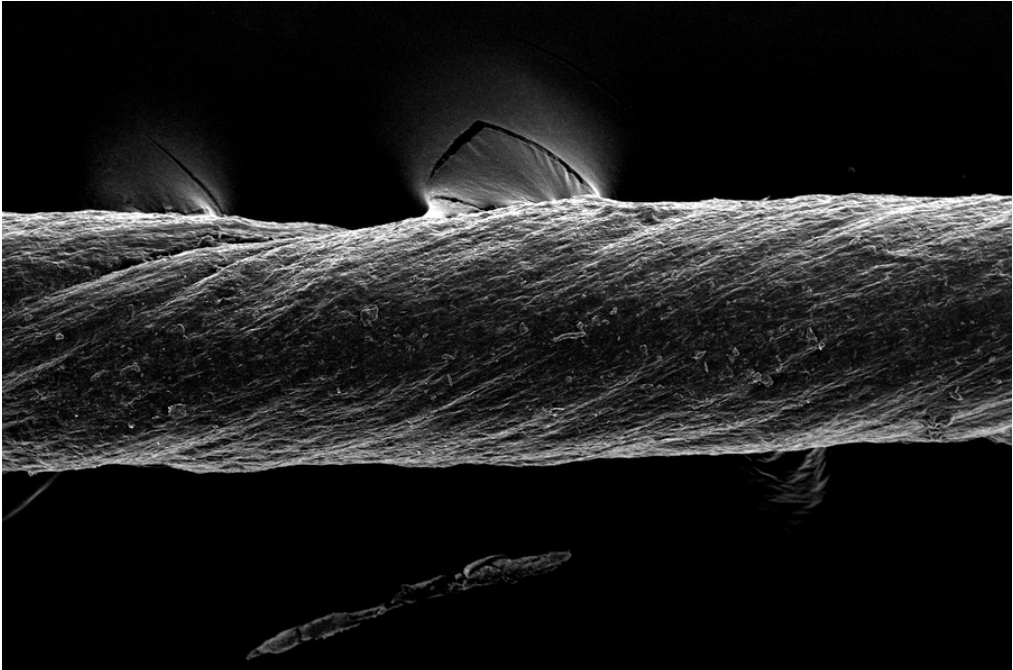 MIT develops smart suture for drug delivery, sensing | GlobalSpec