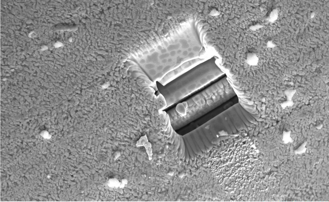 Heart of titanium: Self-expanding metal frame transforms vascular care ...