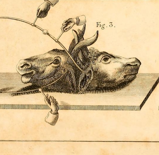 The medical technology of "Frankenstein" | GlobalSpec