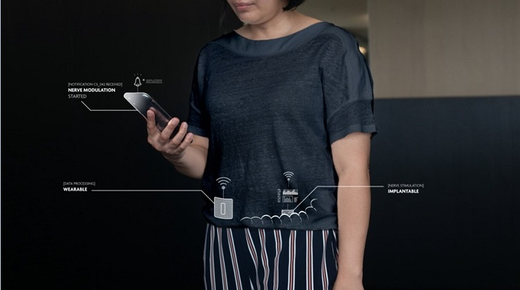 Miniature implants could be a game changer for the peripheral nervous ...