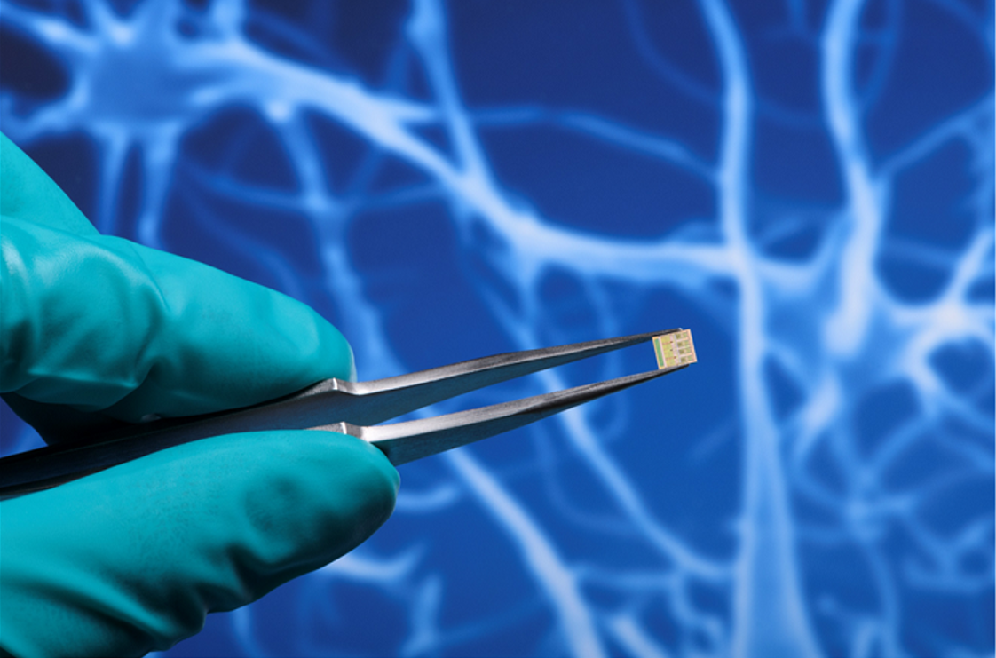 Miniature implants could be a game changer for the peripheral nervous ...