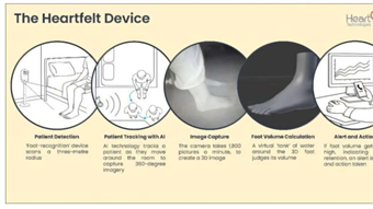 New AI device detects heart failure through foot volume | GlobalSpec